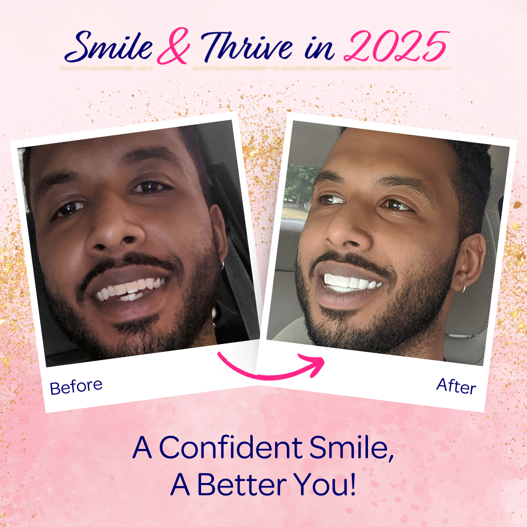 Instasmile UK, Change Your Life with instasmile in 2025 🦷 - Instasmile UK