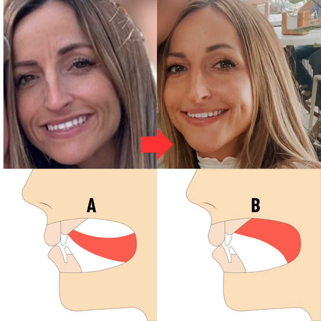 Learn More About Koko Face Yoga Free App